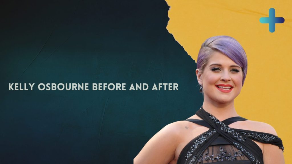 Kelly Osbourne Before And After – Look At Her Unbelievable ...