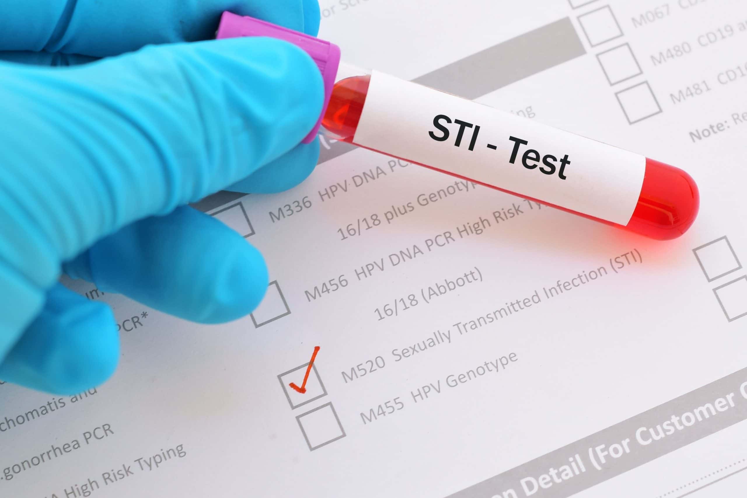 First STI At-Home Test For Chlamydia And Gonorrhea Approved But Several ...