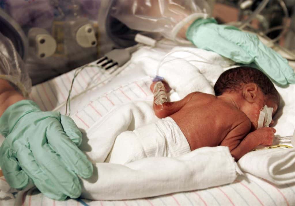 Infant Death Rates Continue To Increase Following Insufficient Medical ...